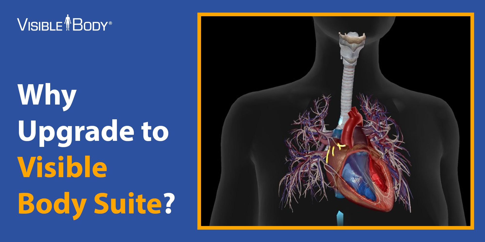 We Have Atlas—Why Upgrade to VB Suite?